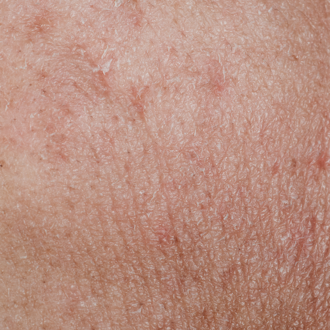 Barebase | Pure Skincare Without Coconut or Compromise – BAREBASE